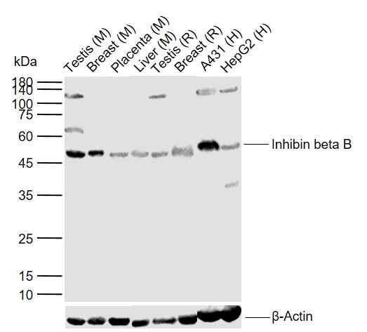 Rabbit Anti-Inhibin beta B antibody_Primary Antibody_Antibody_SUNLONG ...