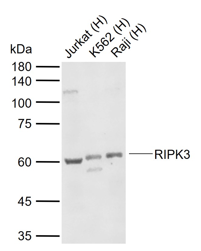 Rabbit Anti-RIPK3 antibody_Primary Antibody_Antibody_SUNLONG BIOTECH CO ...