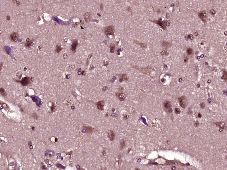 Rabbit Anti-BRAF antibody_Primary Antibody_Antibody_SUNLONG BIOTECH CO ...