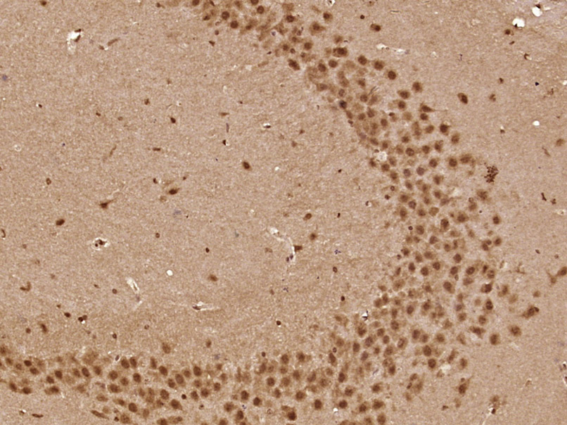 Rabbit Anti-BRAF antibody_Primary Antibody_Antibody_SUNLONG BIOTECH CO ...