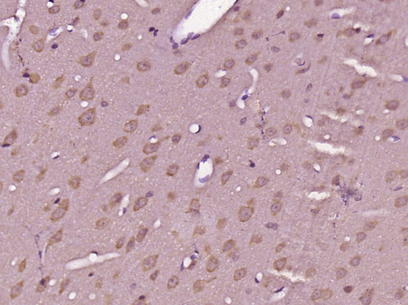 Rabbit Anti-GPR89A antibody_Primary Antibody_Antibody_SUNLONG BIOTECH ...