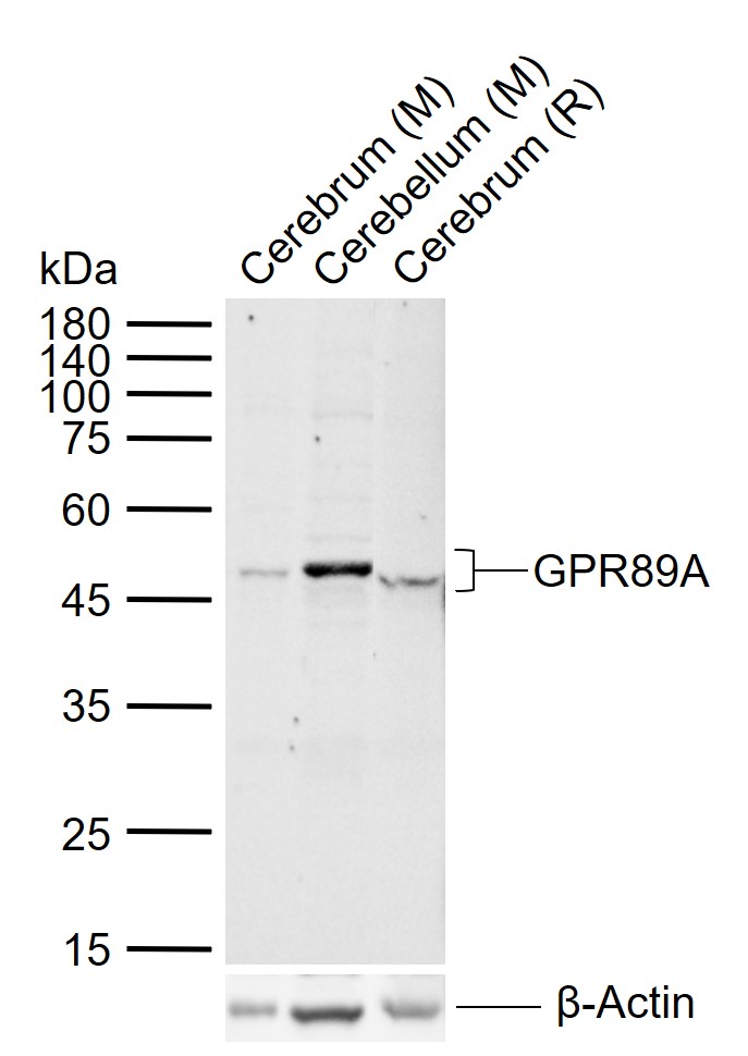 Rabbit Anti-GPR89A antibody_Primary Antibody_Antibody_SUNLONG BIOTECH ...