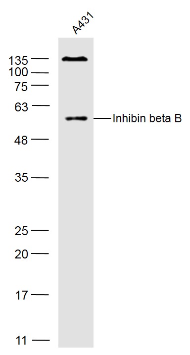 Rabbit Anti-Inhibin beta B antibody_Primary Antibody_Antibody_SUNLONG ...