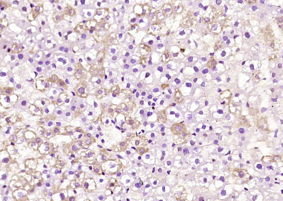 Rabbit Anti-TBCE antibody_Primary Antibody_Antibody_SUNLONG BIOTECH CO ...