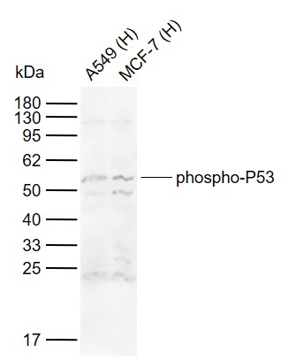 Rabbit Anti-phospho-P53 (Ser15)antibody_Primary Antibody_Antibody ...