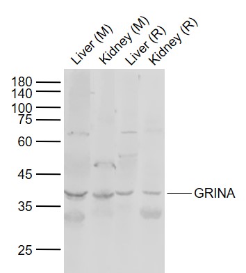 Rabbit Anti-GRINA antibody_Primary Antibody_Antibody_SUNLONG BIOTECH CO ...